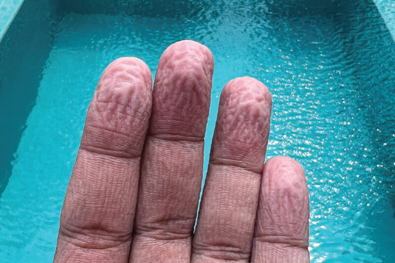 Study on Finger Wrinkles - RobinAge